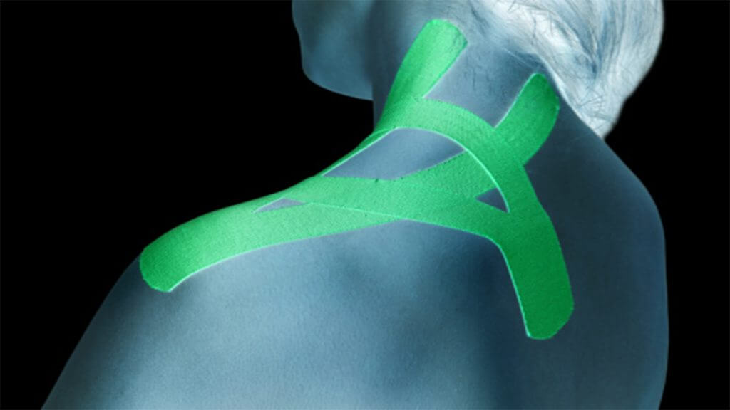 Benefits of Kinesiotape for Sub acromial impingement – Lakky ...